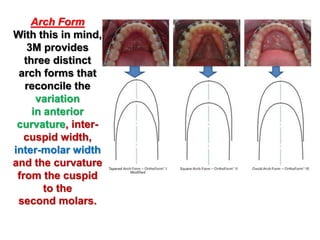 Preformed Archwire Spring Ballista