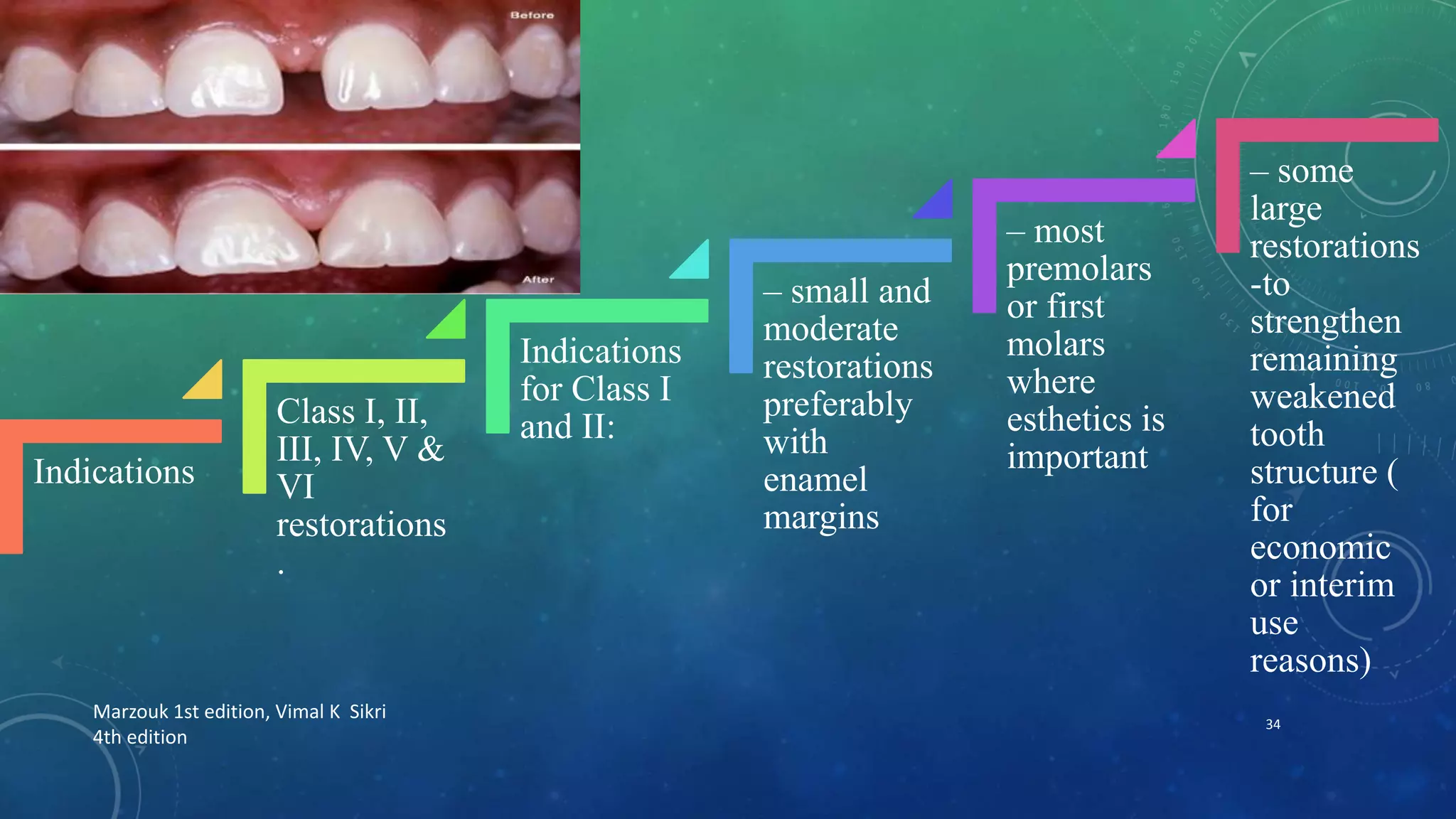 Selection of restorative materials | PPTX