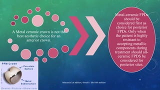 Selection of restorative materials | PPTX