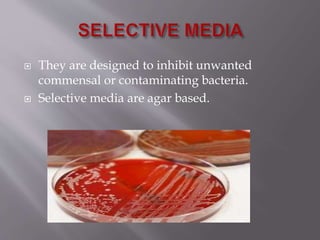 Selective and enrichment media | PPTX
