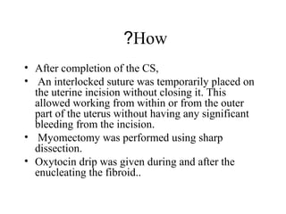 Selective cesarean myomectomy | PPT