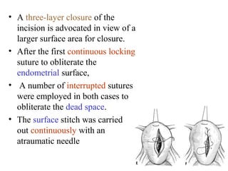 Selective cesarean myomectomy | PPT