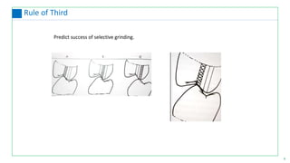 Selective grinding | PPTX