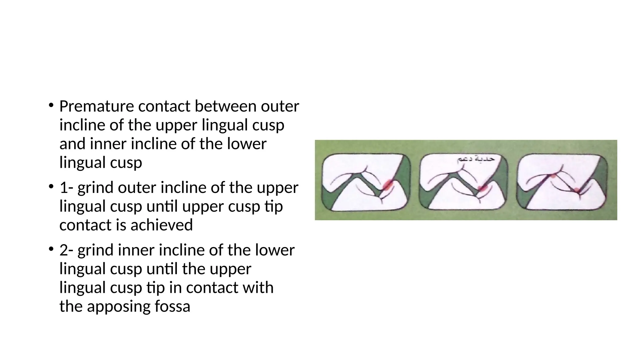 Selective grinding for occlusion adjustment pptx | PPTX