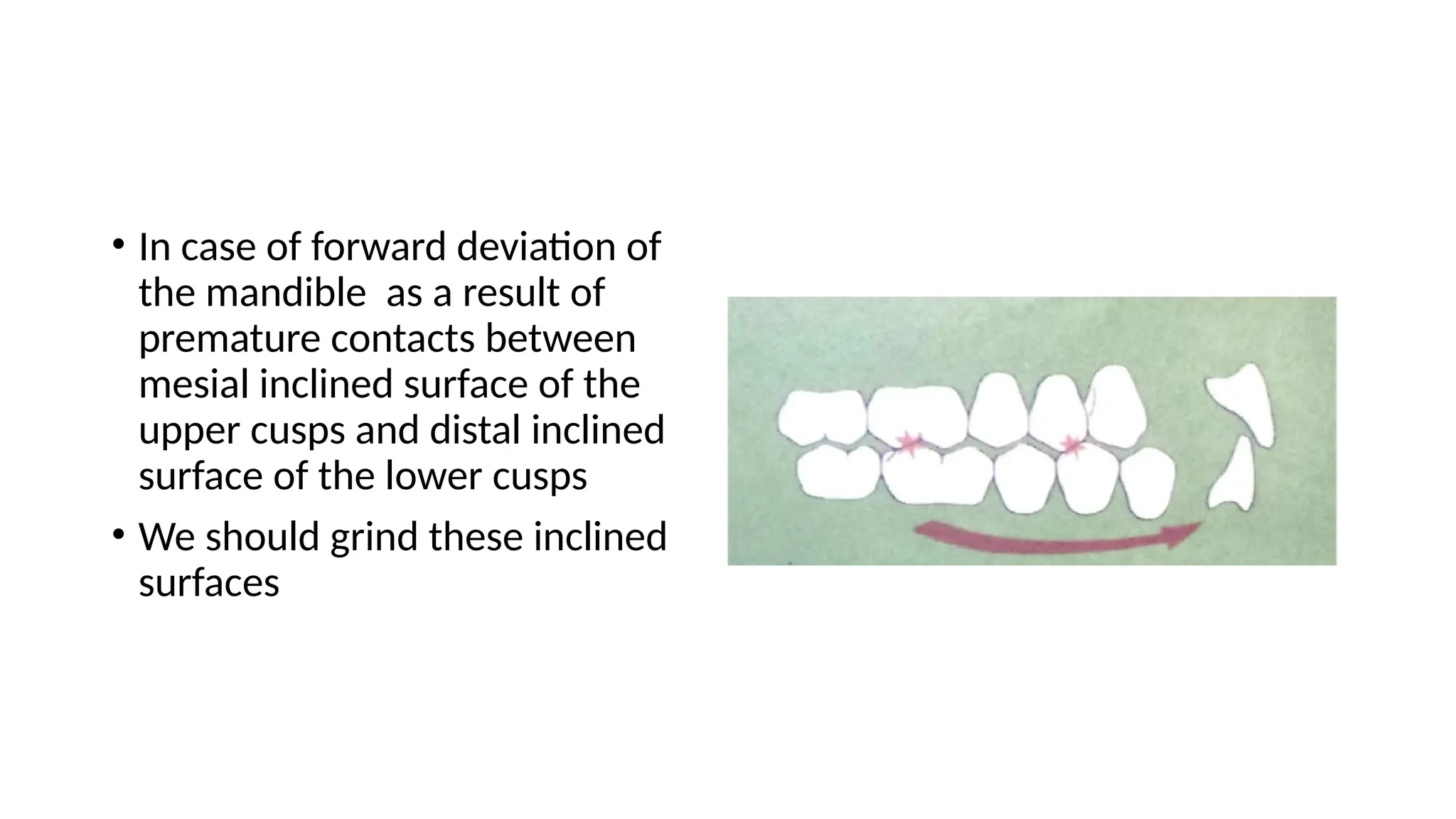 Selective grinding for occlusion adjustment pptx | PPTX