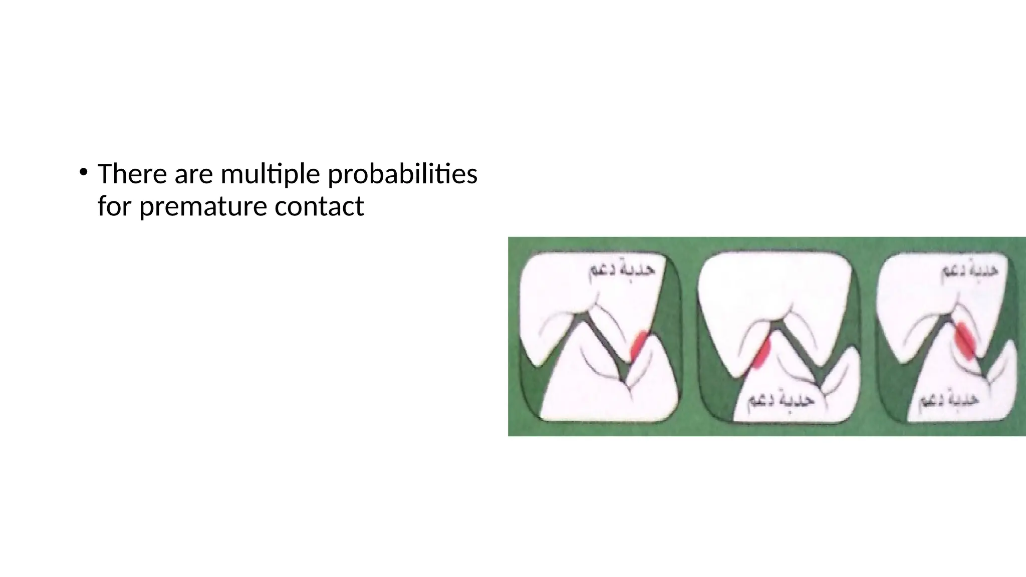 Selective grinding for occlusion adjustment pptx | PPTX