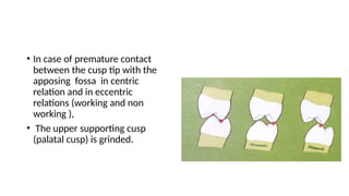 Selective grinding for occlusion adjustment pptx | PPTX