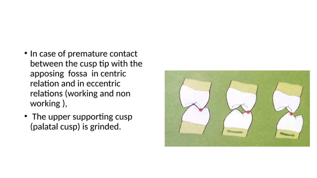 Selective grinding for occlusion adjustment pptx | PPTX | Dental Health | Diseases and Conditions