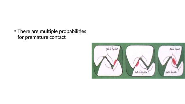 Selective grinding for occlusion adjustment pptx | PPTX | Dental Health | Diseases and Conditions