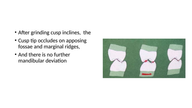 Selective grinding for occlusion adjustment pptx | PPTX | Dental Health | Diseases and Conditions