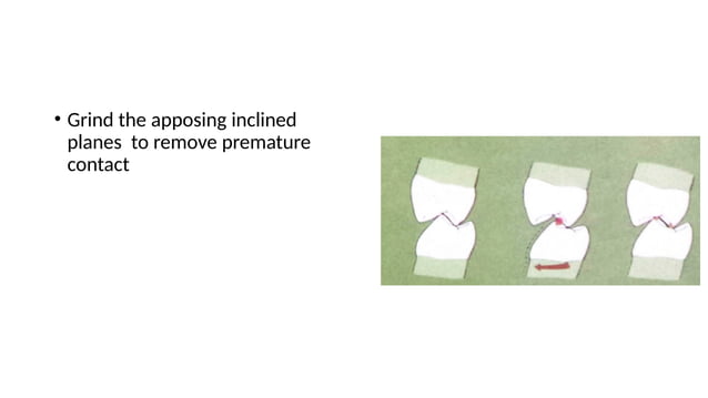 Selective grinding for occlusion adjustment pptx | PPTX | Dental Health | Diseases and Conditions