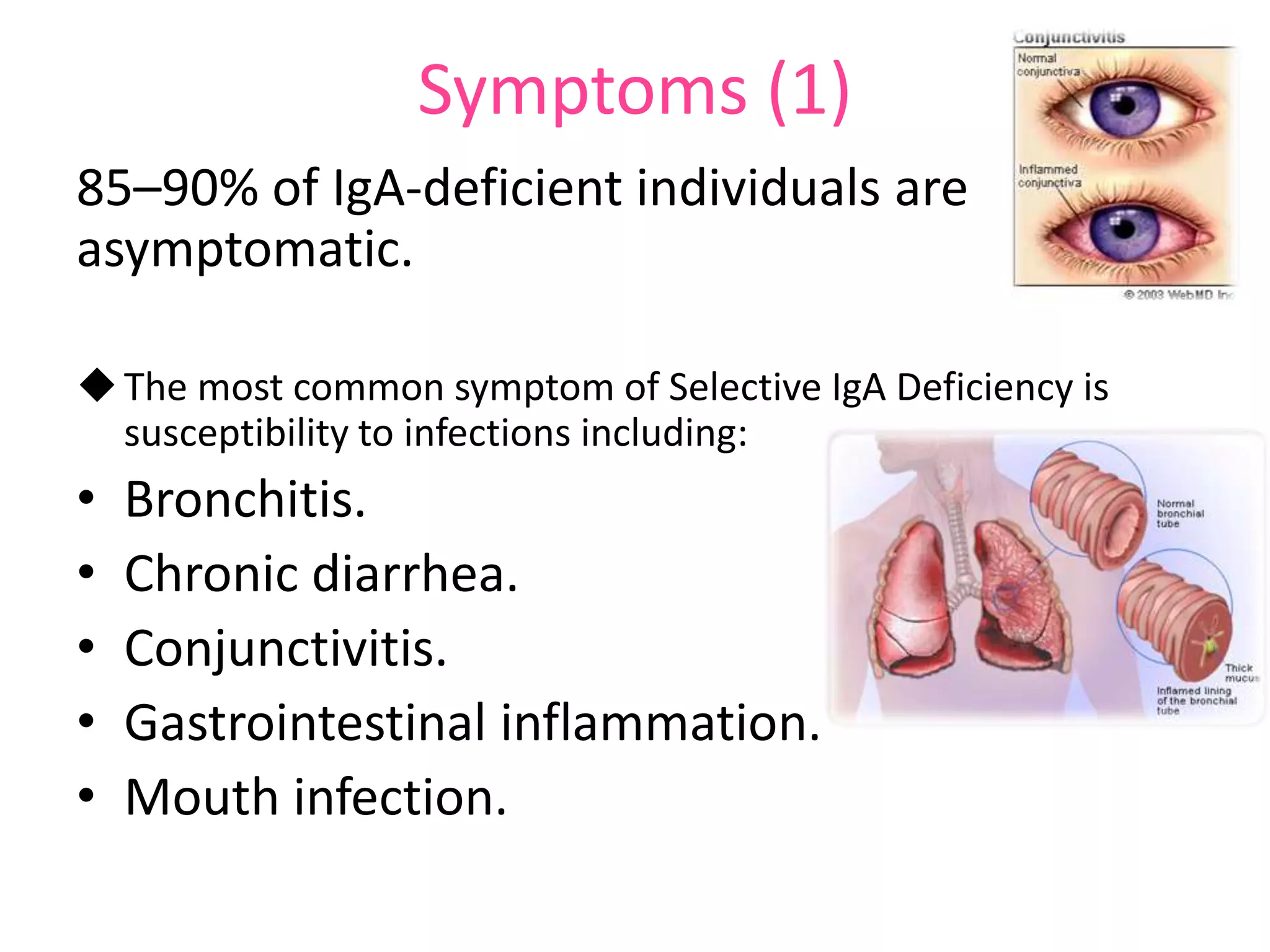 Selective igA deficiency | PPTX