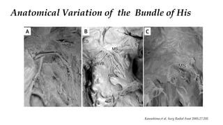 Selective vs nonselective his bundle capture | PPT