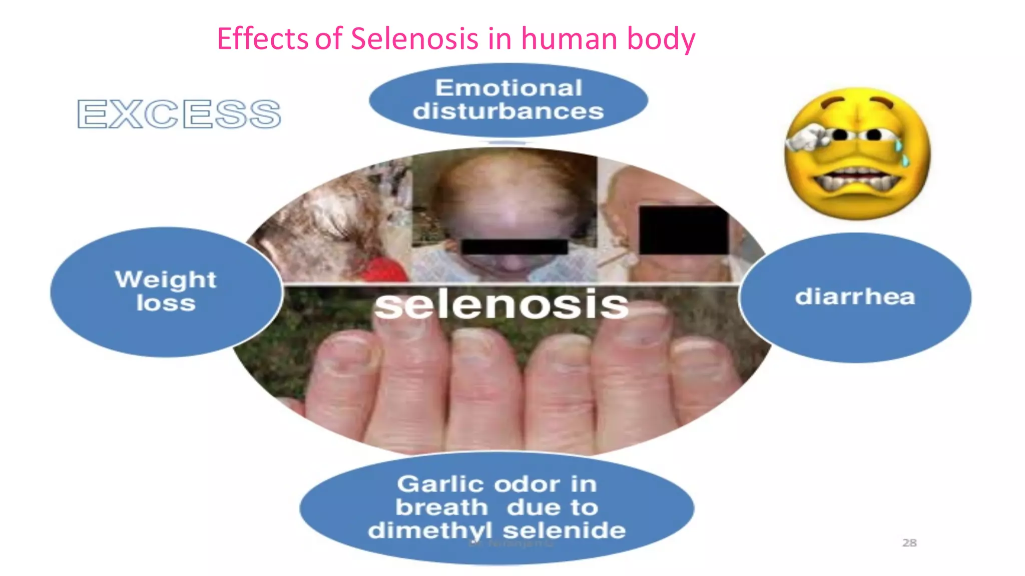 Selenium metabolism and its clinical significance | PDF