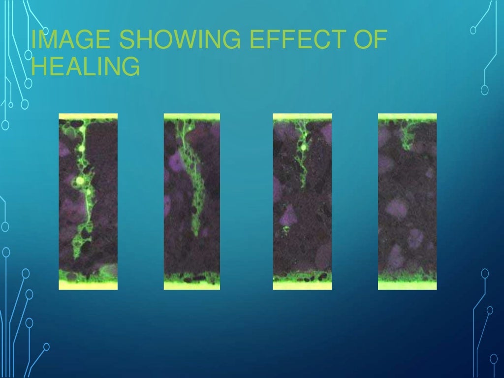Self healing-material-bacterial-concrete Self healing-material-bacterial-concrete