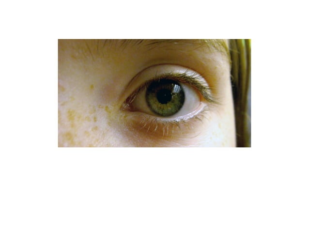 Self portrait-eye structure | PPT