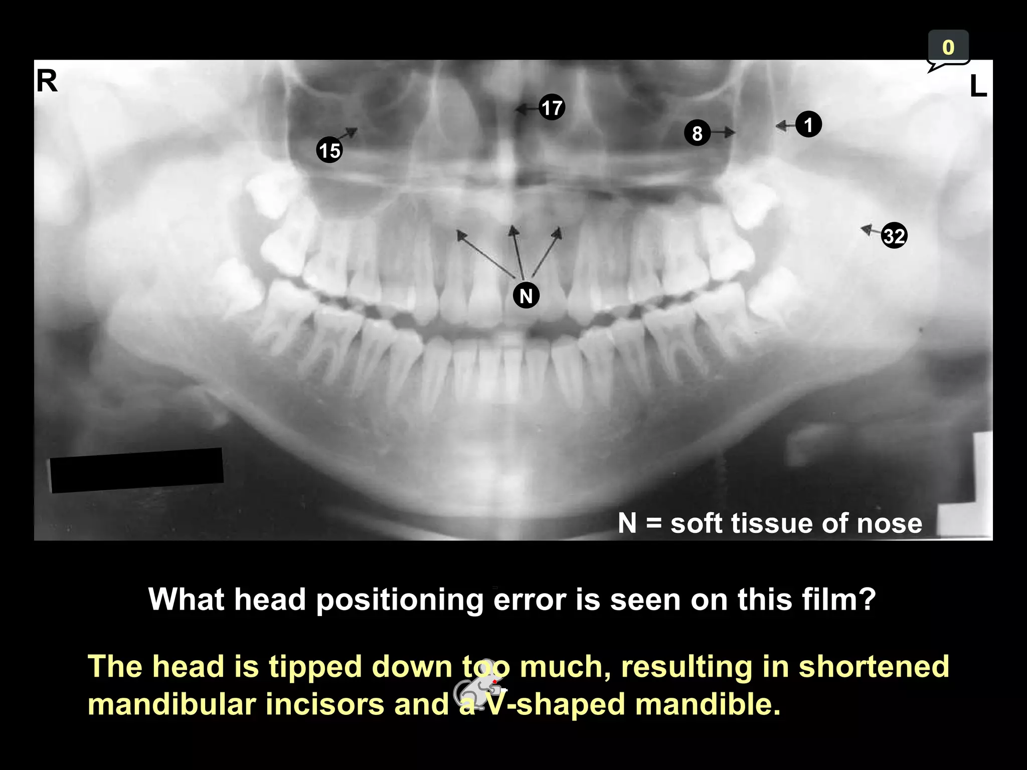 Self study-pan-anatomy | PPT