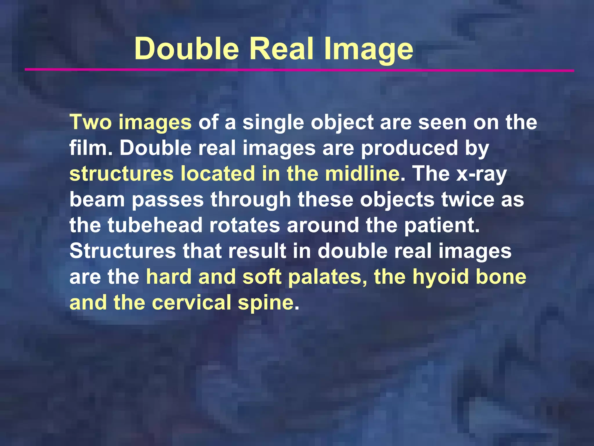 Self study-pan-anatomy | PPT
