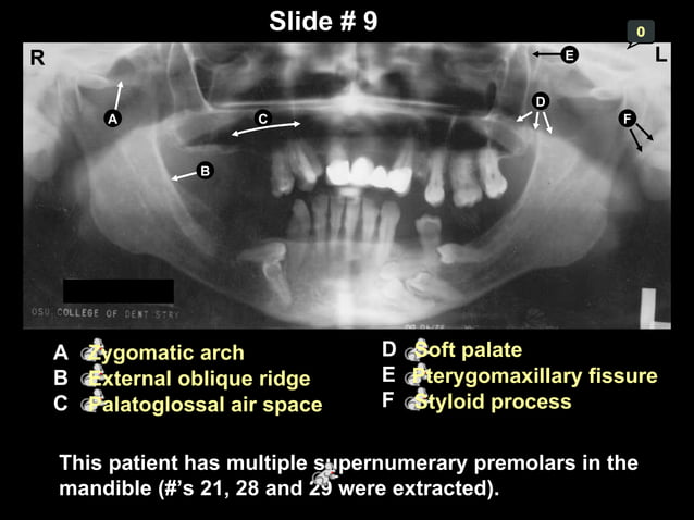 Self study-pan-anatomy | PPT