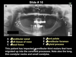 Self study-pan-anatomy | PPT