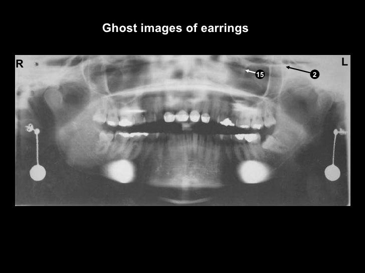 Self study-pan-anatomy