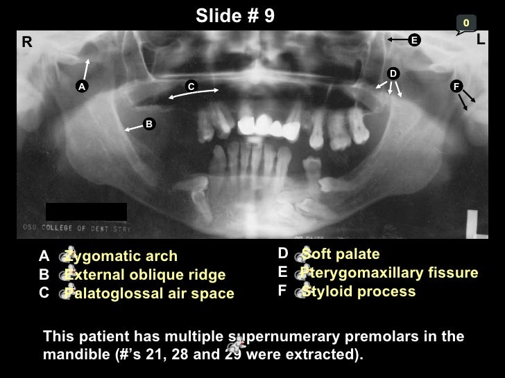 Pan- Definition Anatomy at Chad Frierson blog