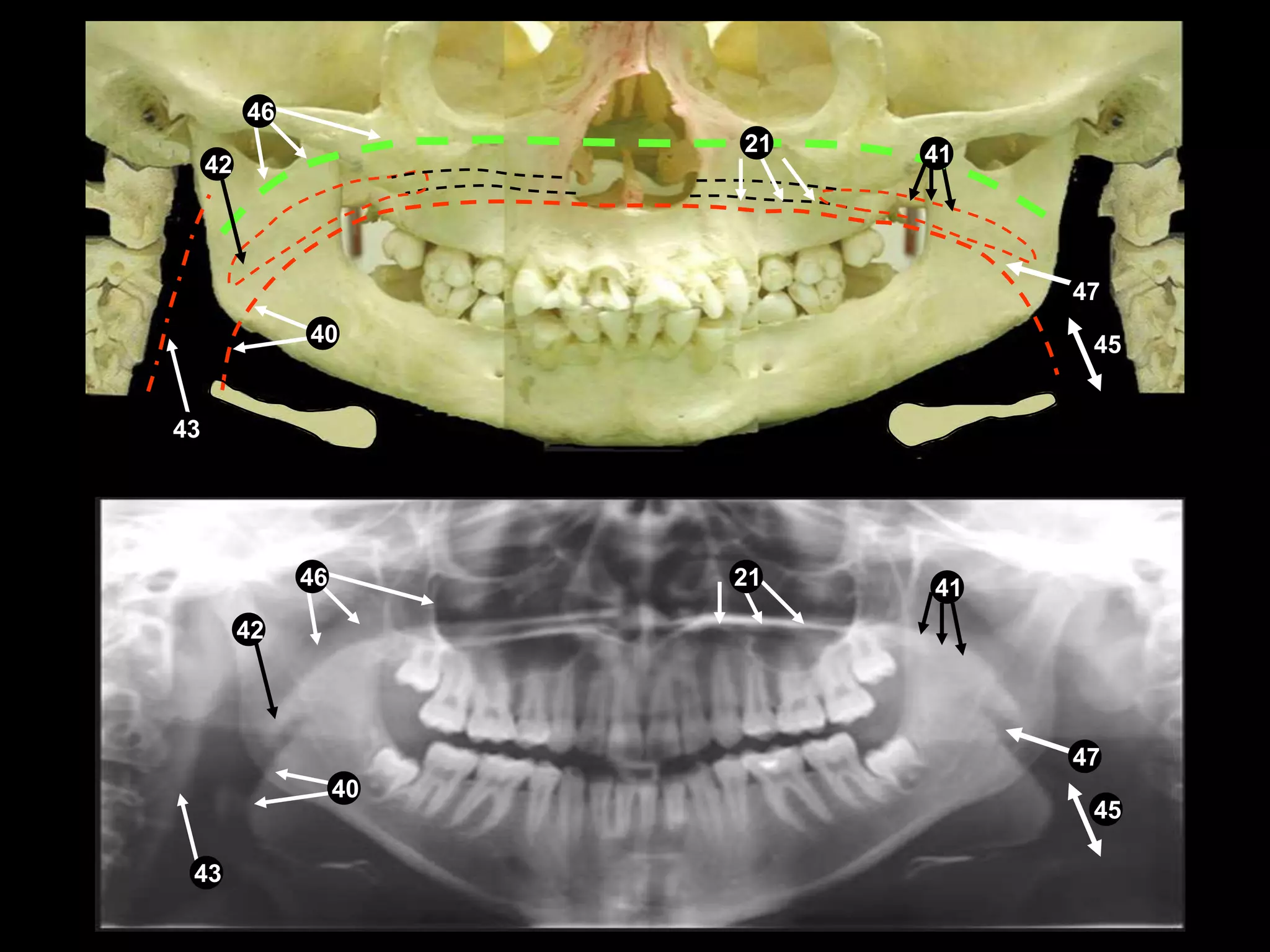 Self study-pan-anatomy | PPTX
