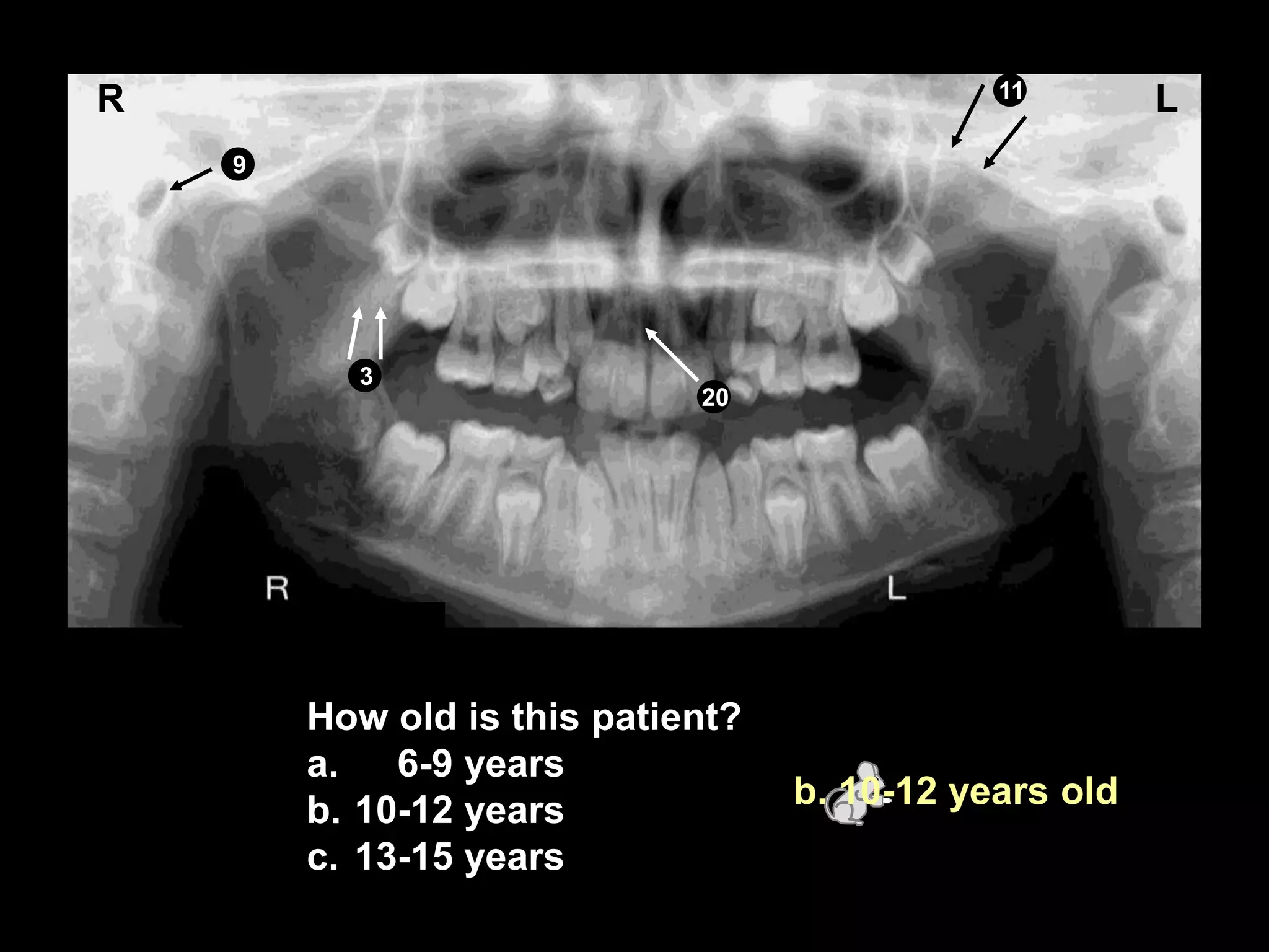 Self study-pan-anatomy | PPTX