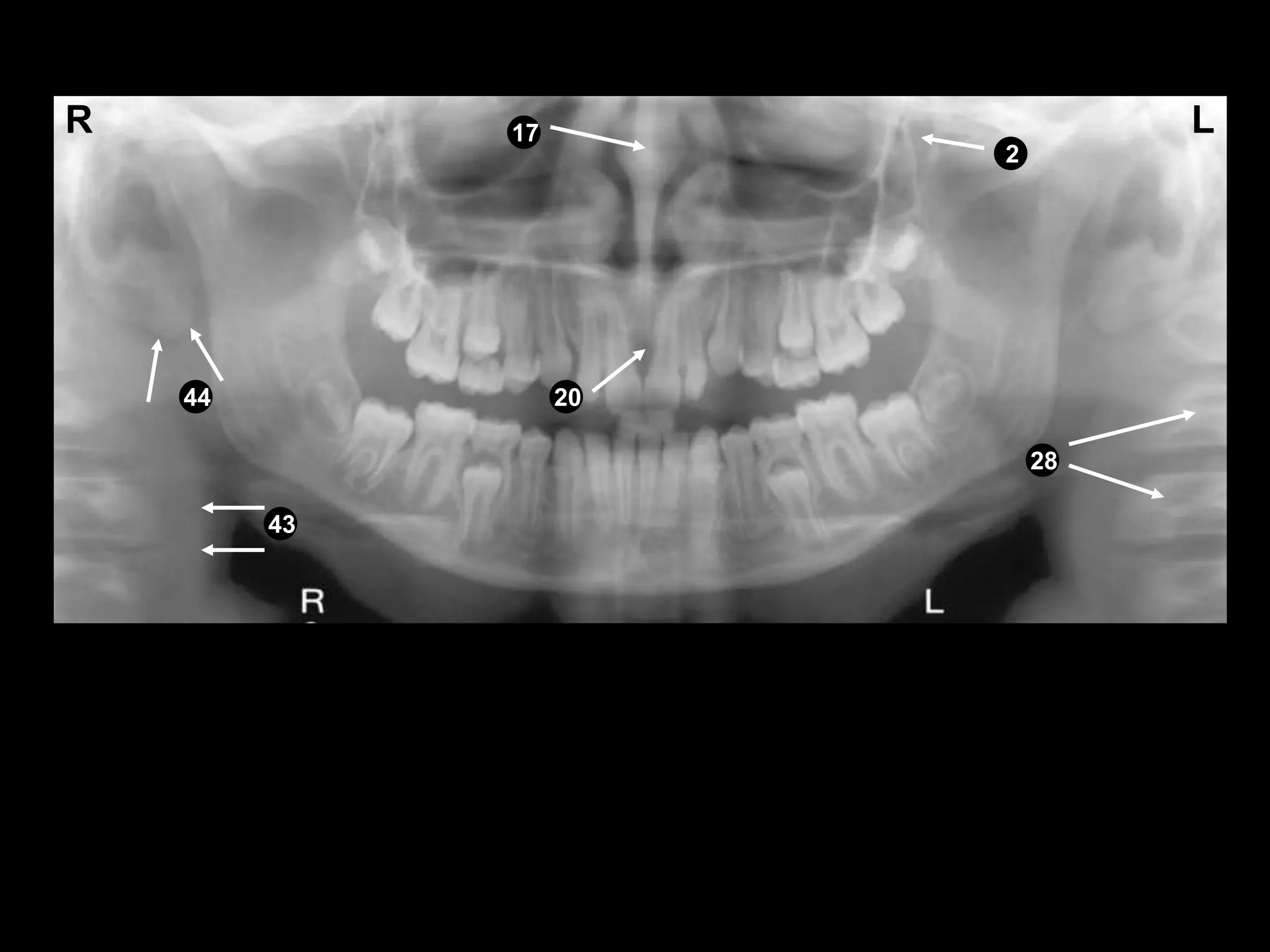 Self study-pan-anatomy | PPTX