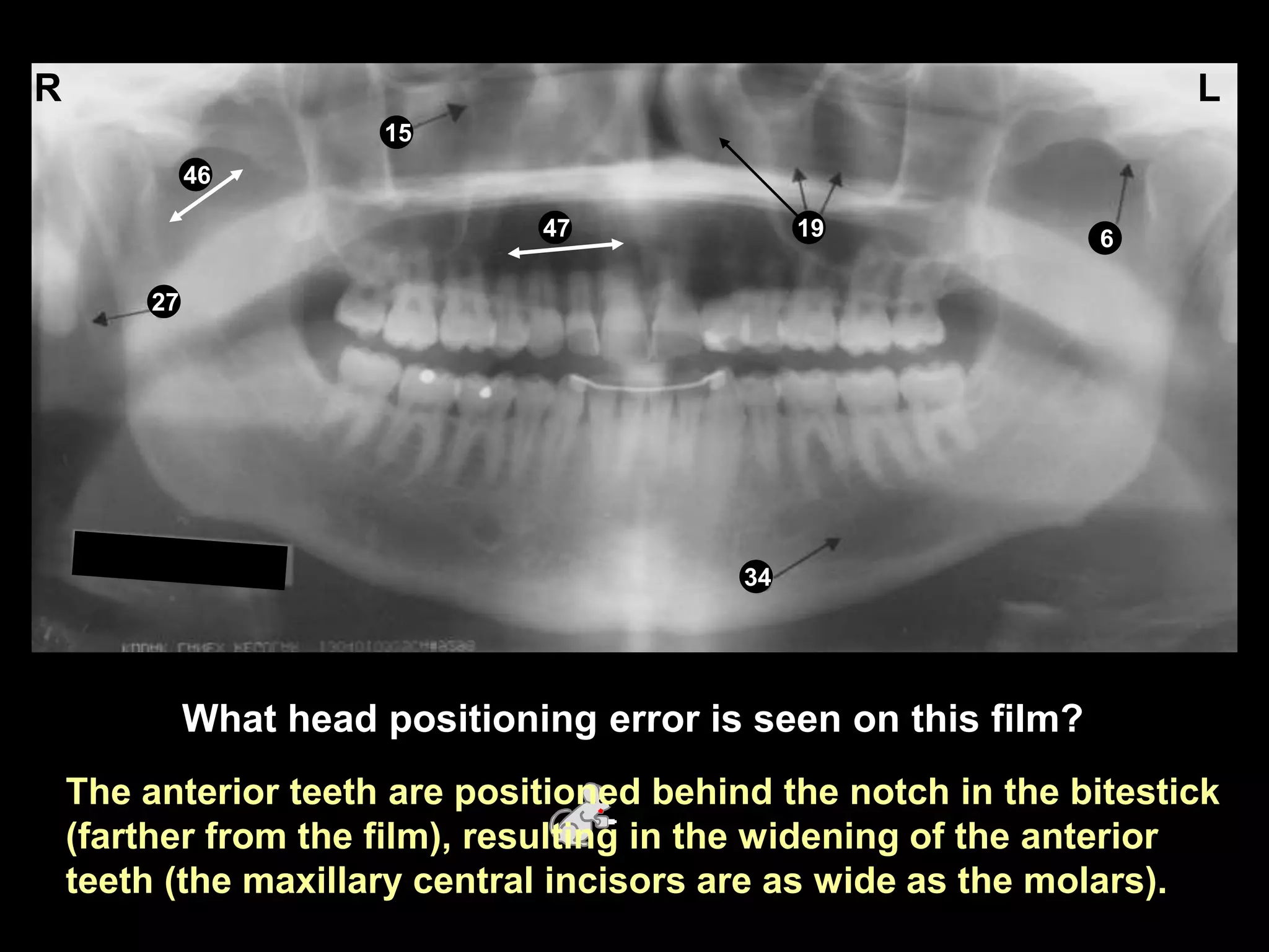 Self study-pan-anatomy | PPTX