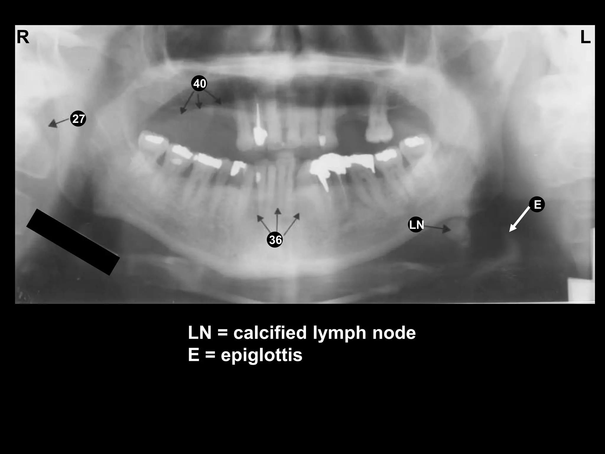 Self study-pan-anatomy | PPTX