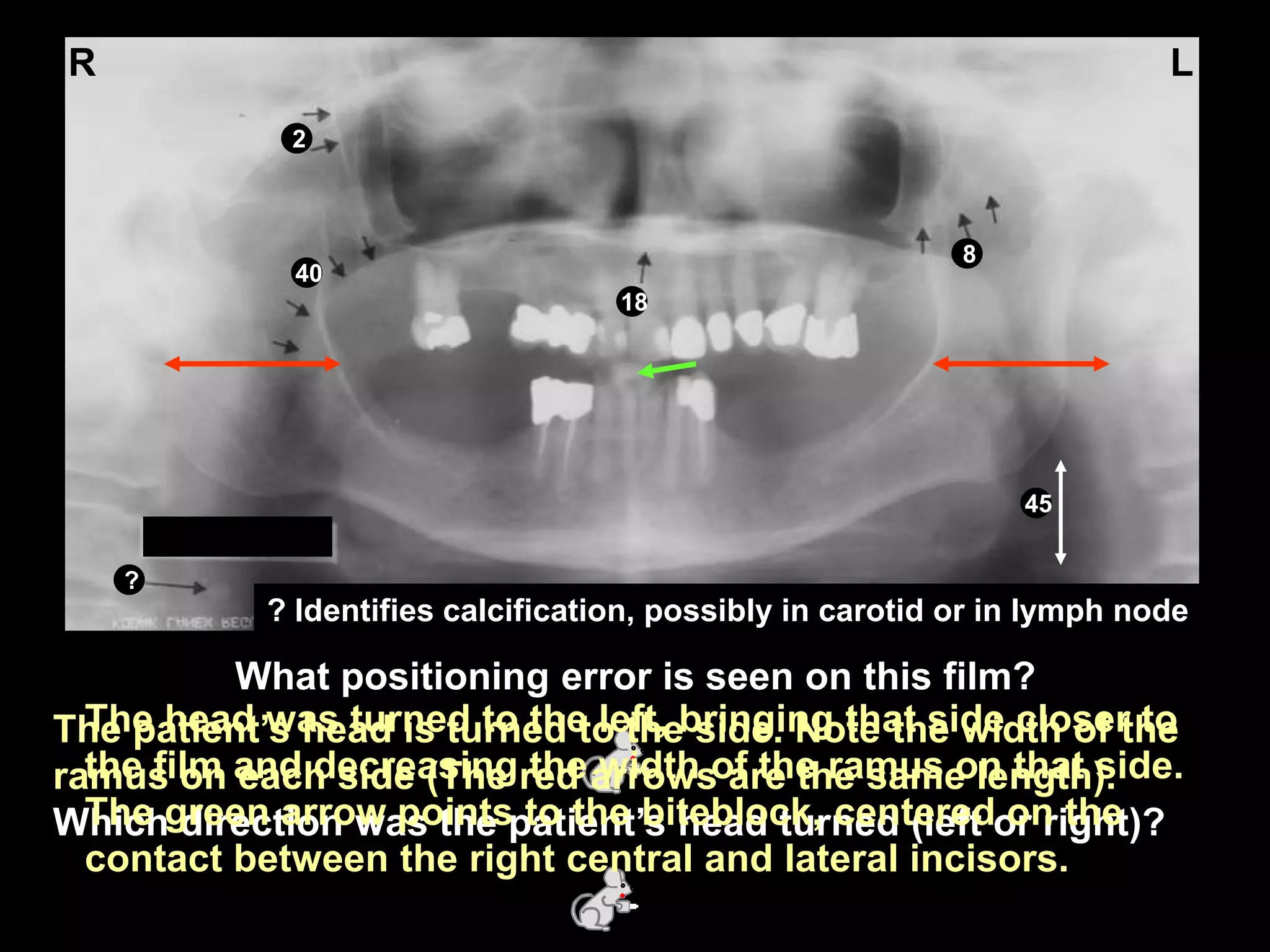 Self study-pan-anatomy | PPTX