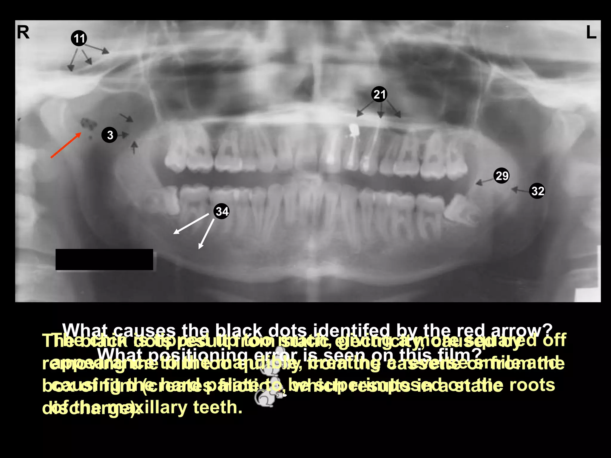 Self study-pan-anatomy | PPTX