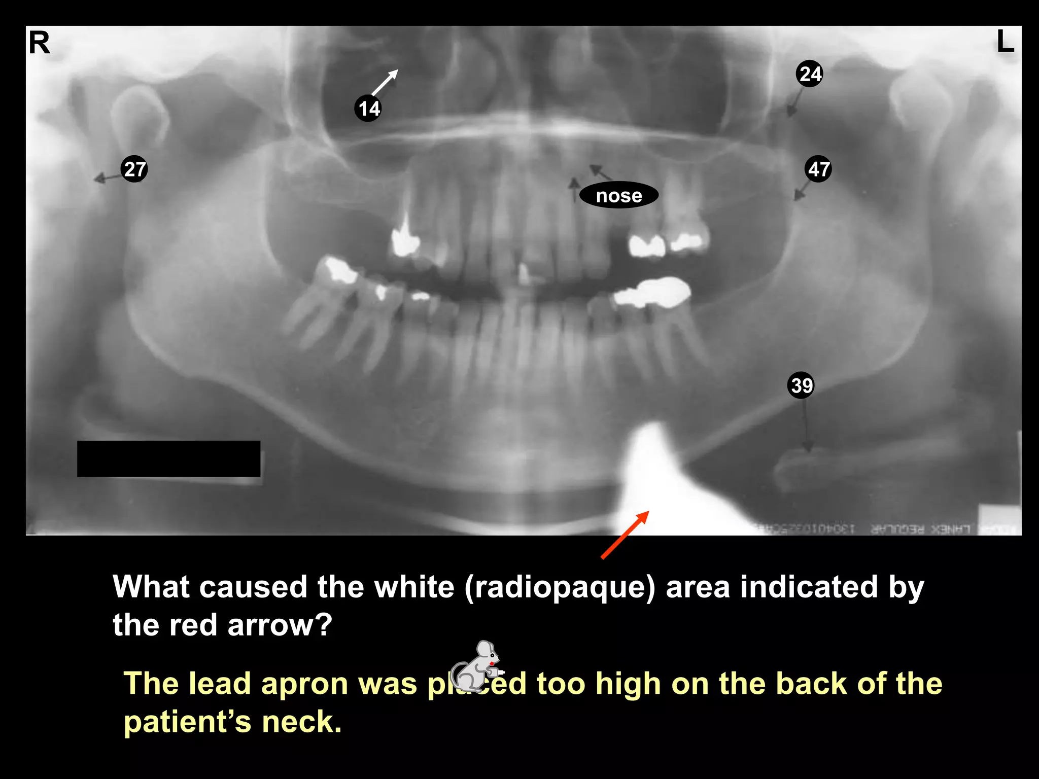 Self study-pan-anatomy | PPTX