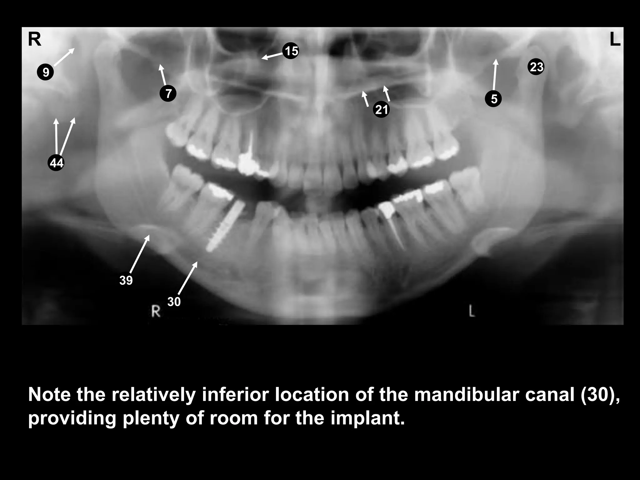 Self study-pan-anatomy | PPTX