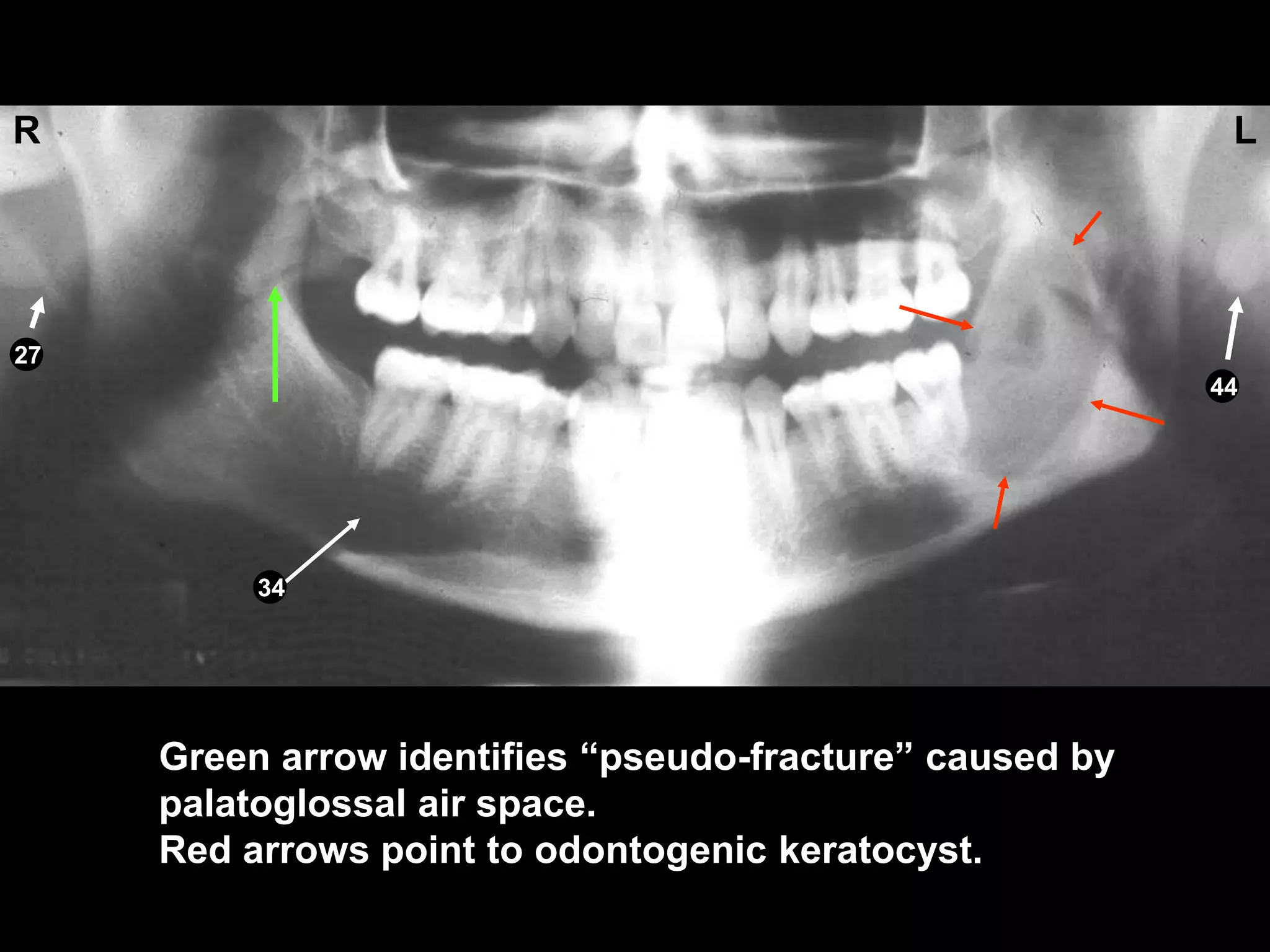 Self study-pan-anatomy | PPTX