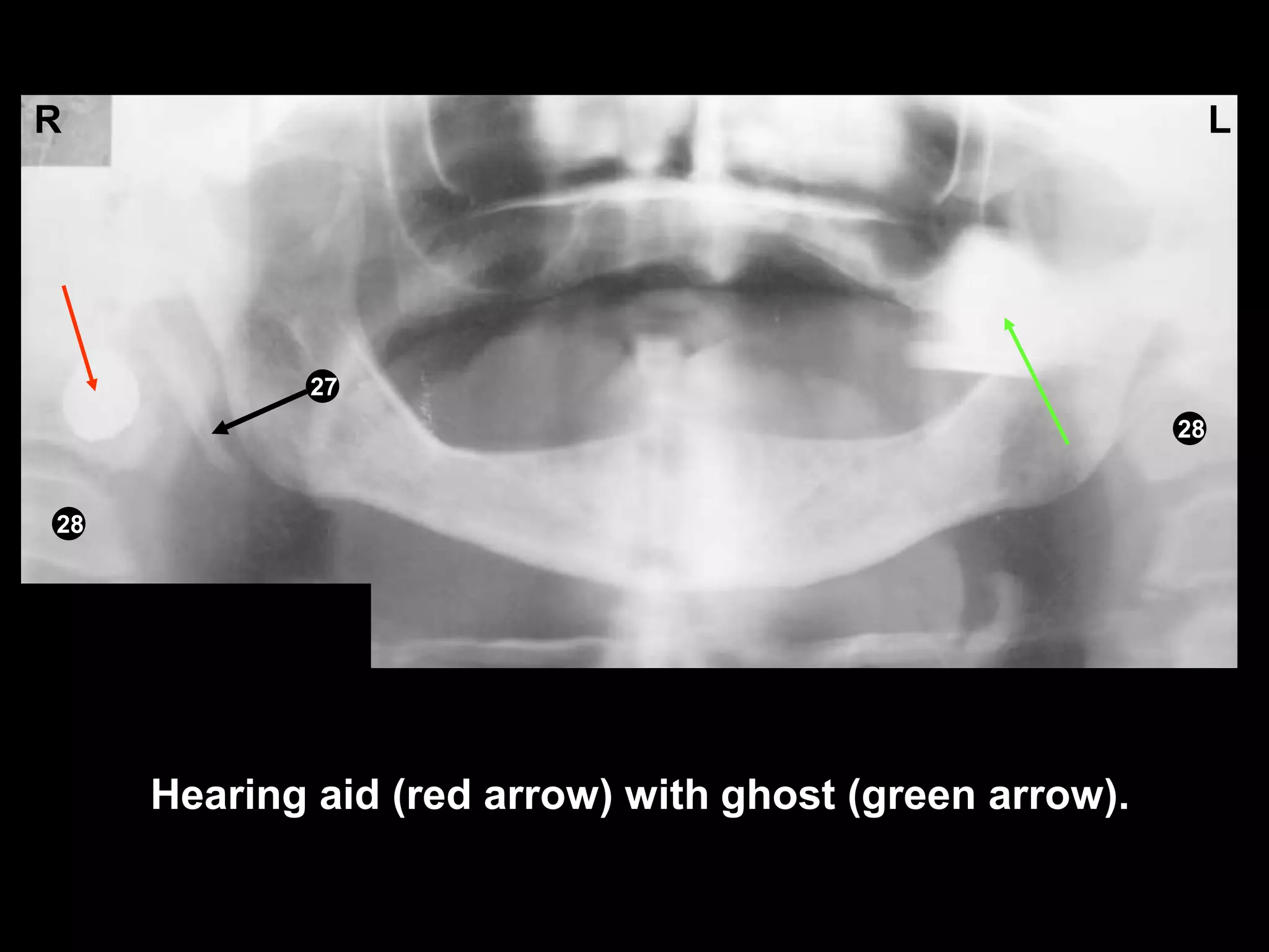 Self study-pan-anatomy | PPTX