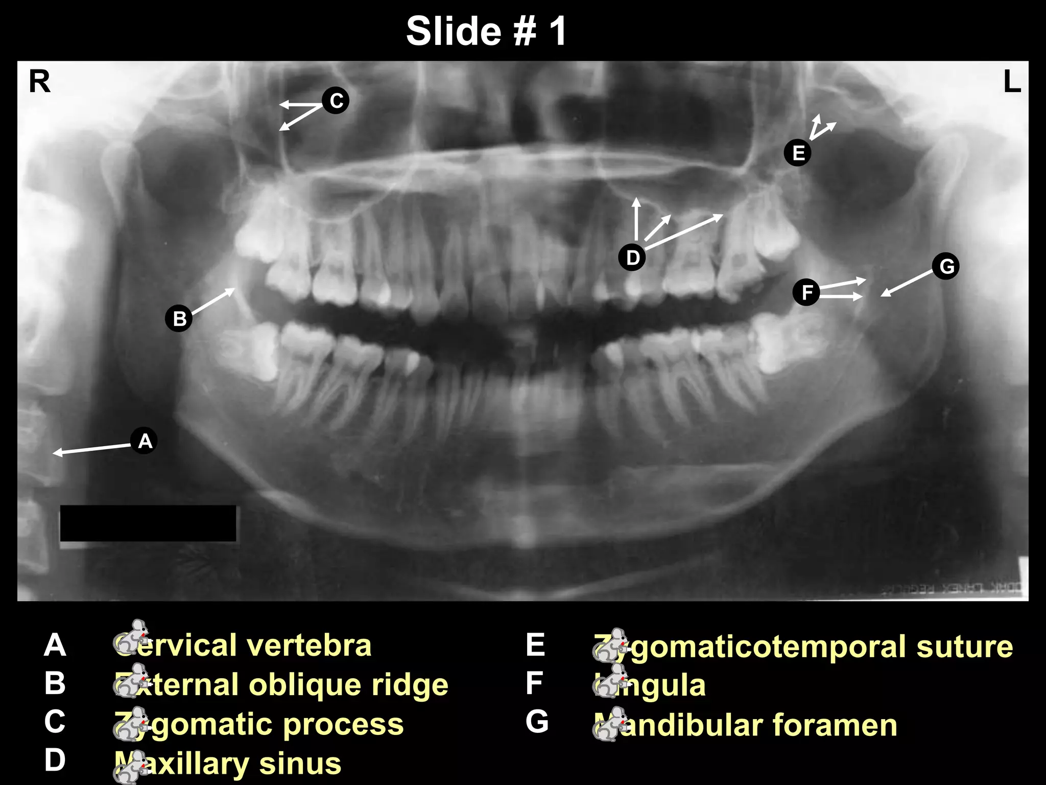 Self study-pan-anatomy | PPTX