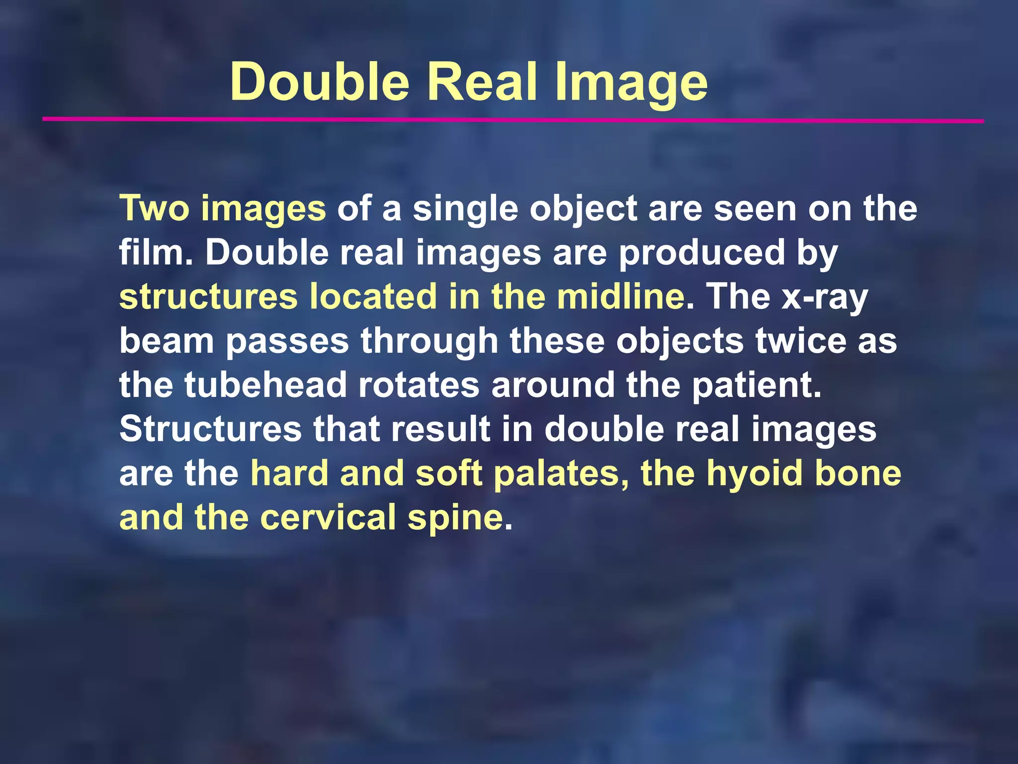 Self study-pan-anatomy | PPTX