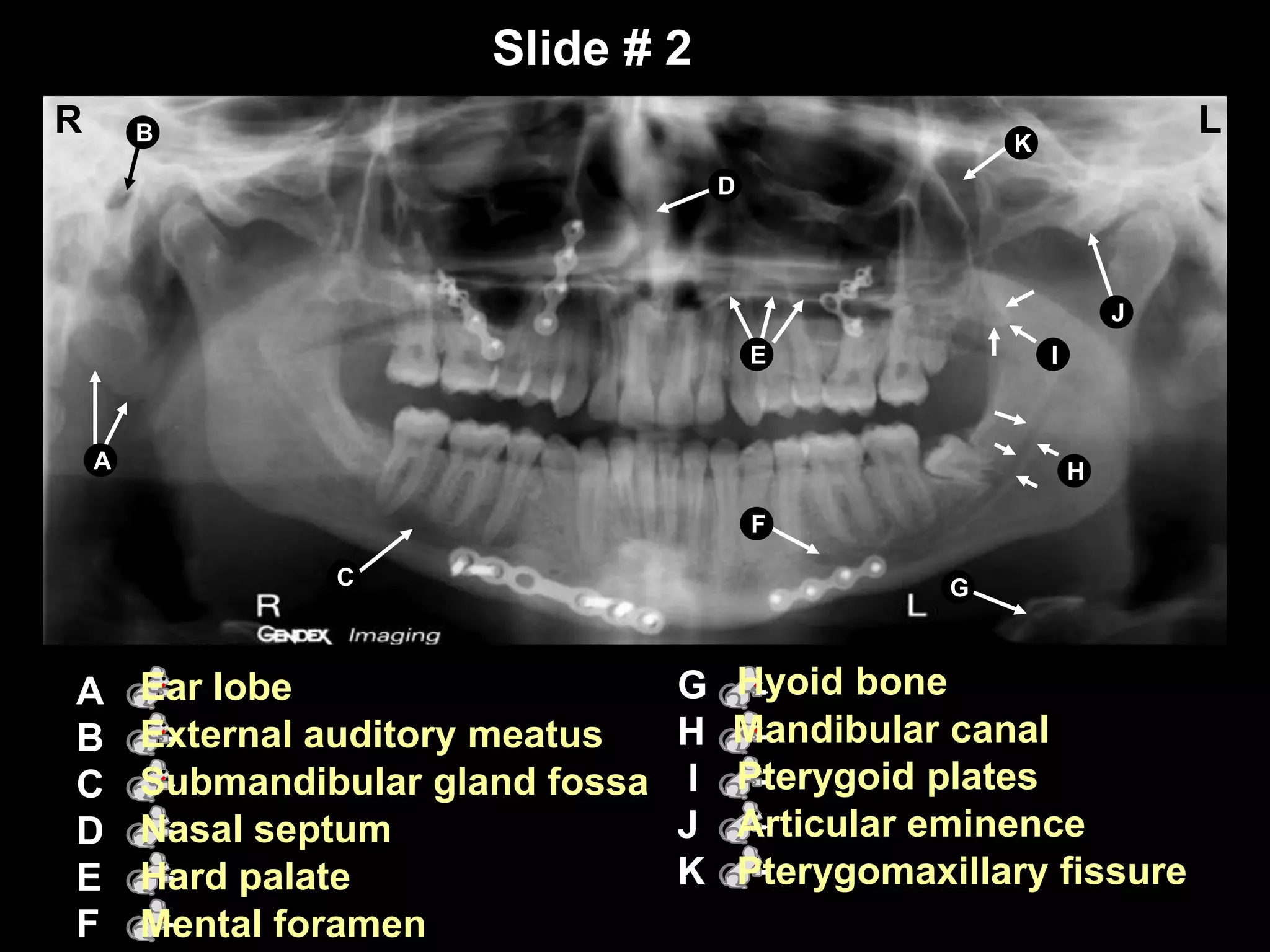 Self study-pan-anatomy | PPTX
