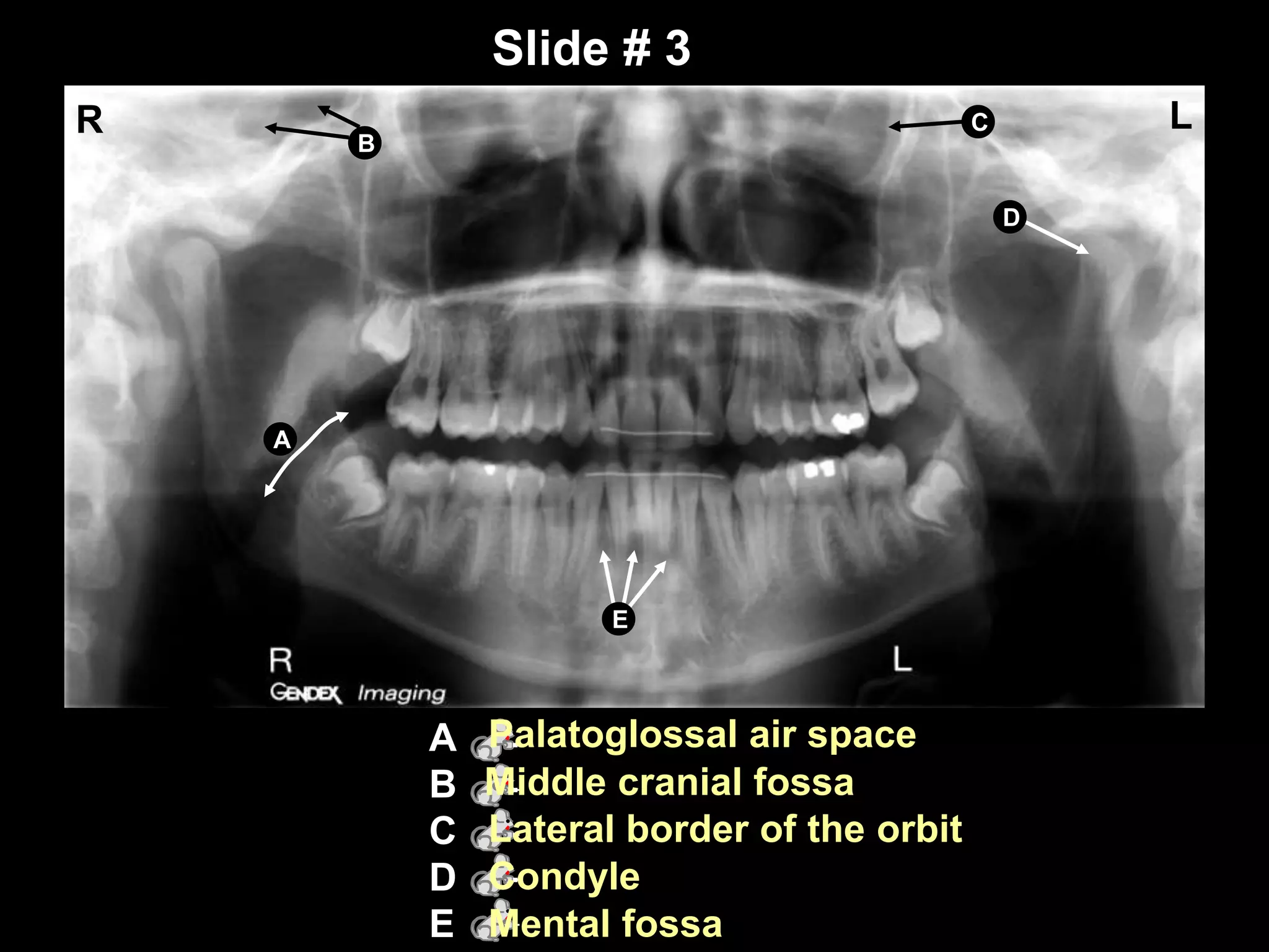 Self study-pan-anatomy | PPTX