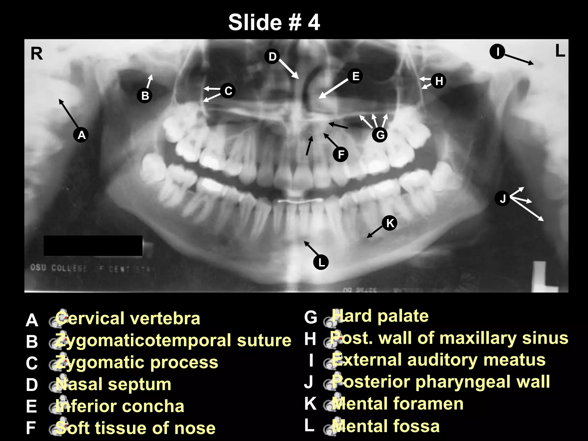 Self study-pan-anatomy | PPTX