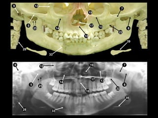 Self study-pan-anatomy | PPTX