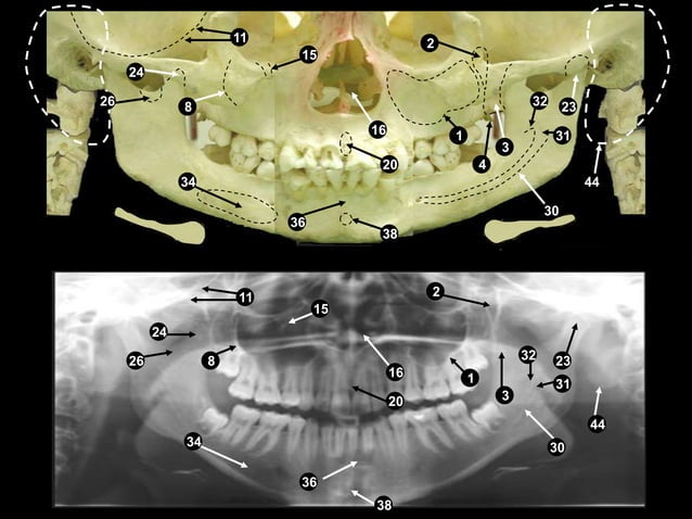 Self study-pan-anatomy | PPTX