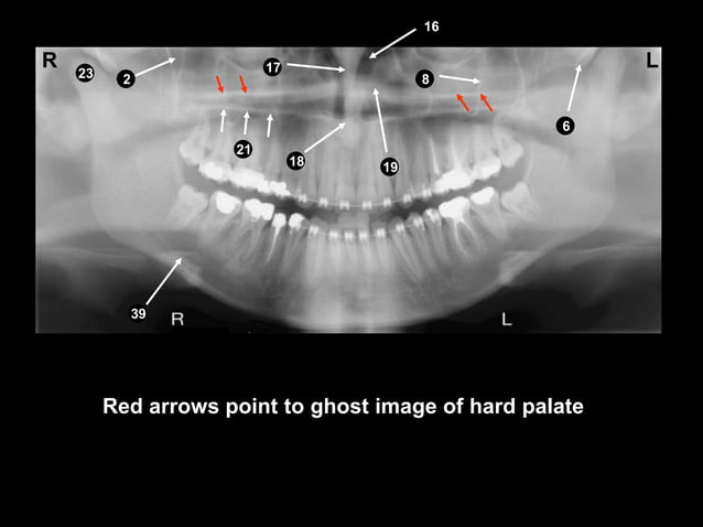 Self study-pan-anatomy | PPTX