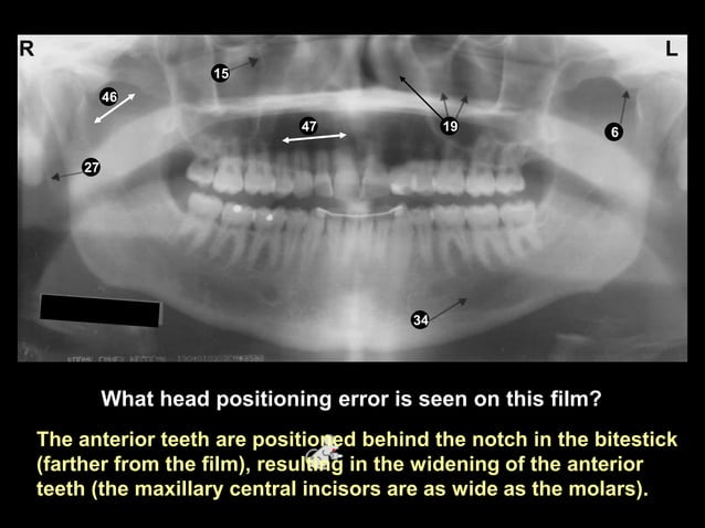 Self study-pan-anatomy | PPTX