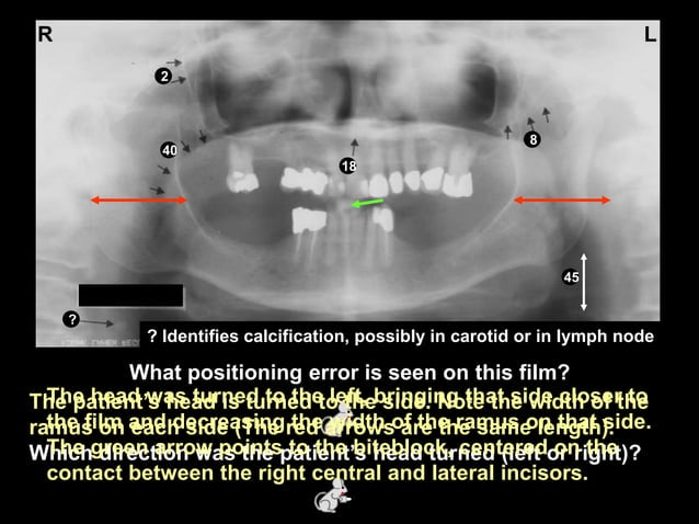 Self study-pan-anatomy | PPTX