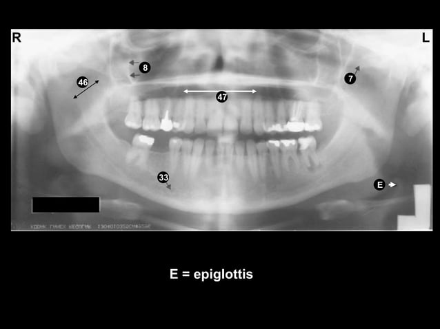 Self study-pan-anatomy | PPTX