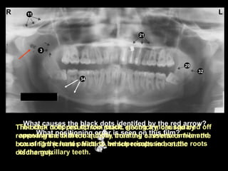 Self study-pan-anatomy | PPTX