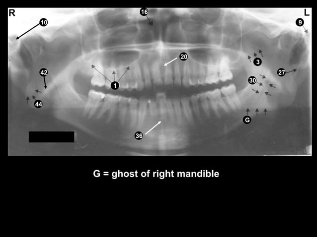 Self study-pan-anatomy | PPTX